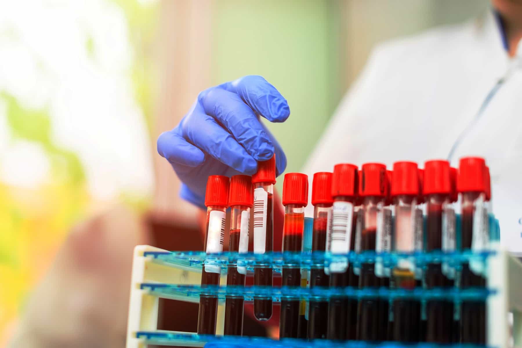 Test Results | Byron Medical Practice